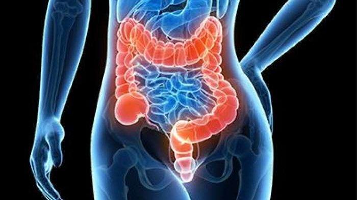 Gejala TBC Usus, Penyakit yang Merenggut Nyawa Ustadz Maaher, Gejala ...