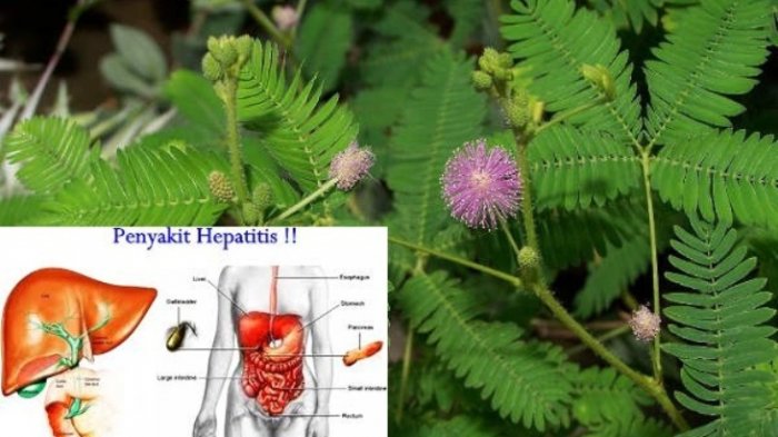 Tumbuhan Liar Putri Malu Sering Diabaikan, Ternyata Punya Khasiat yang Gak Diduga Lho - Tribun ...