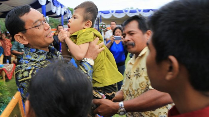 Menebar Kasih, Begini Kepedulian JR Saragih untuk Anak Penderita ...