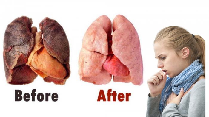 Ini Resep Membersihkan Paru-paru Anda dari Racun dan Tar Rokok - Tribun ...