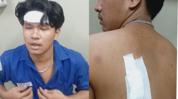 Bentrok Mahasiswa Polmed, Satu Orang Terluka, Begini Kondisinya ...