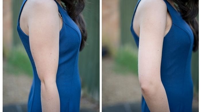 Tips Mengecilkan Lengan dengan Cepat, Lakukan Ini Setiap Hari - Tribun ...