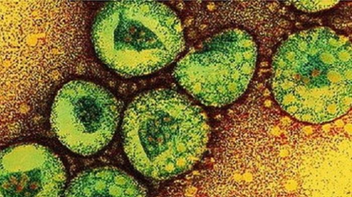 Asal Muasal Virus Corona China Mulai Terkuat, Mirip dengan Virus Ular ...