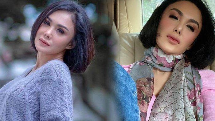 Foto Yuni Shara ini Sedot Perhatian, Perubahan Wajahnya Bikin Netizen Syok: Cantik yang Dulu ...