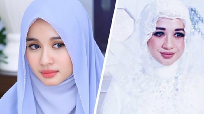 Nasib Artis Cantik Hampir Dinikahi Cucu Presiden, Pilih Dinikahi Duda, Kini Malah Cerai ...