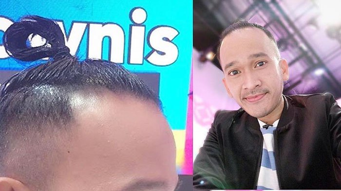 Ubah Gaya Rambutnya, Bagaimana Menurut Kamu Tampilan Terbaru Ruben Onsu? - Tribun-medan.com