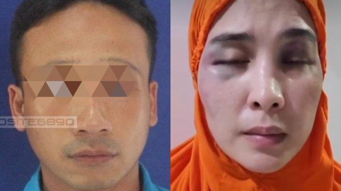 Liciknya Suami Putri Balqis, Ngaku Operasi agar tak Ditahan,Ternyata Liburan ke Lombok Sama ...