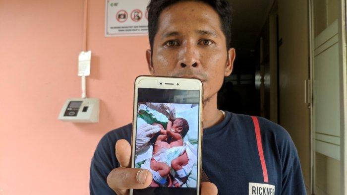 BREAKINGNEWS: Pascaoperasi, Kondisi Ibu Bayi Kembar Siam di RSUP Haji Adam Malik Mulai Membaik ...