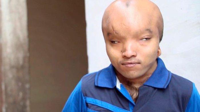 Kerap Dipanggil Alien karena Miliki Kepala Besar dan Sipit, Pria ini ...