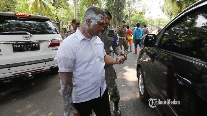 Muhammad Sofyan Dianjurkan untuk Operasi, Luka Bakar Serius di Kepala dan Lengan Sebelah Kanan ...