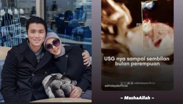 Kabar Syahrini Hamil Anak Pertama, Sahabat Reino Barack Mengaku Tak Sabar Gendong Keponakan ...