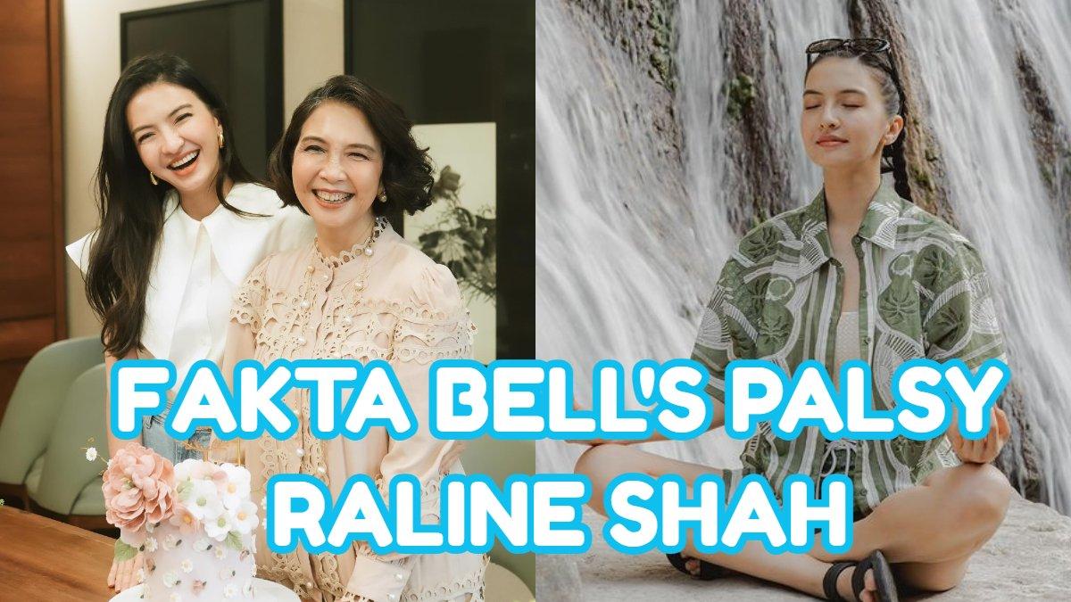 5 Fakta Raline Shah Terkena Bell's Palsy, Setengah Wajahnya Tak Bisa ...