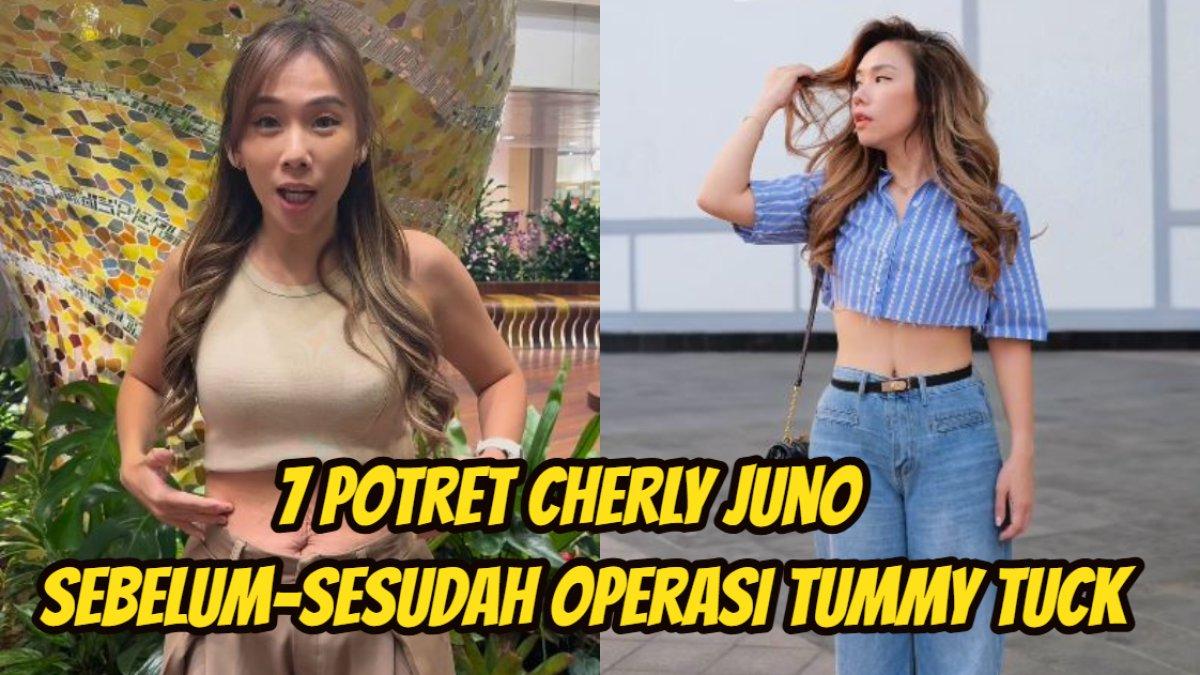 7 Potret Cherly Juno Eks Cherrybelle Sebelum-Sesudah Operasi Tummy Tuck, Istri Arthur Makin ...