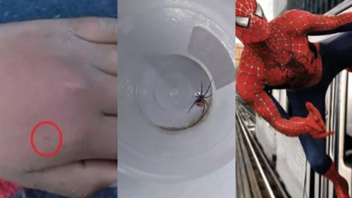 Ingin Jadi Spider-Man, Bocah Biarkan Tangannya Digigit Laba-laba ...