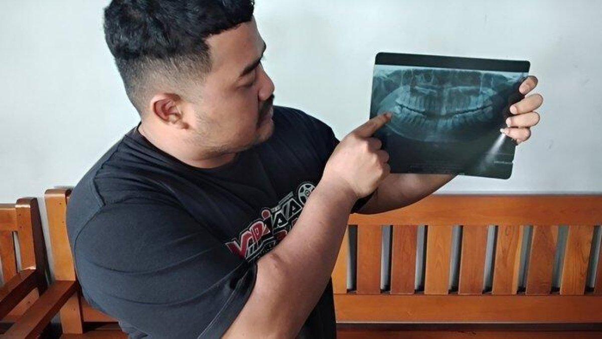 Curhat Pilu Davin, Istri Meninggal Usai Cabut Gigi di Klinik Ngawi ...