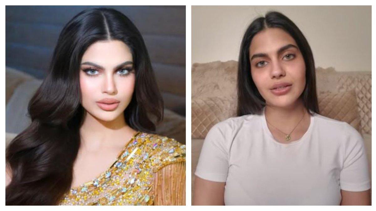 Sosok & Profil Rachel Gupta, Ratu Kecantikan India Mundur dari Miss ...