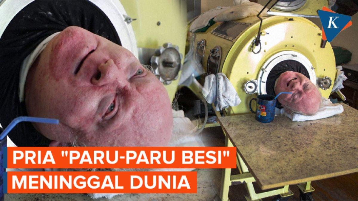 Sosok Paul Alexander, Manusia yang Hidup di Paru-paru Besi, Kini ...