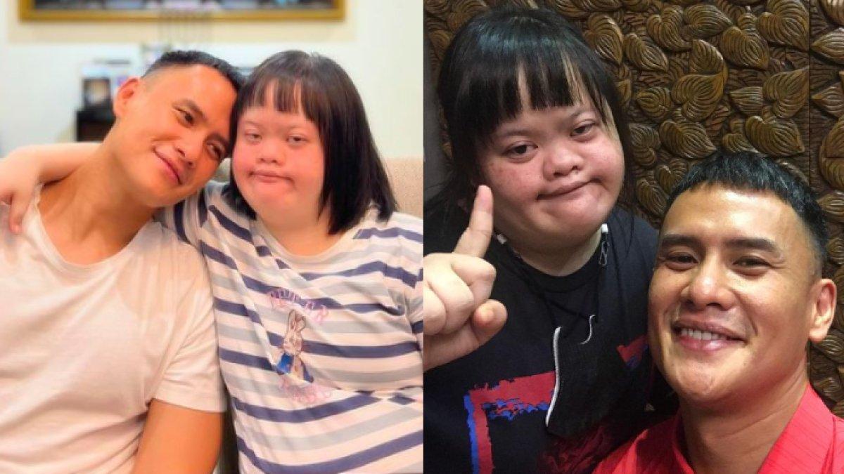 7 Potret Choky Sitohang dengan Chitra Adiknya Penyandang Down Syndrome ...