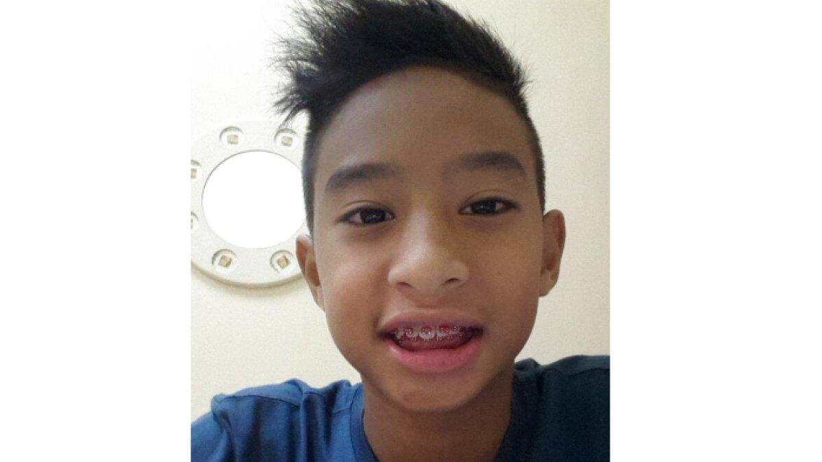 Tahu Bocah Pakai Behel Ini? Kini Jadi Penyanyi dan Aktor, Sempat Mau ...