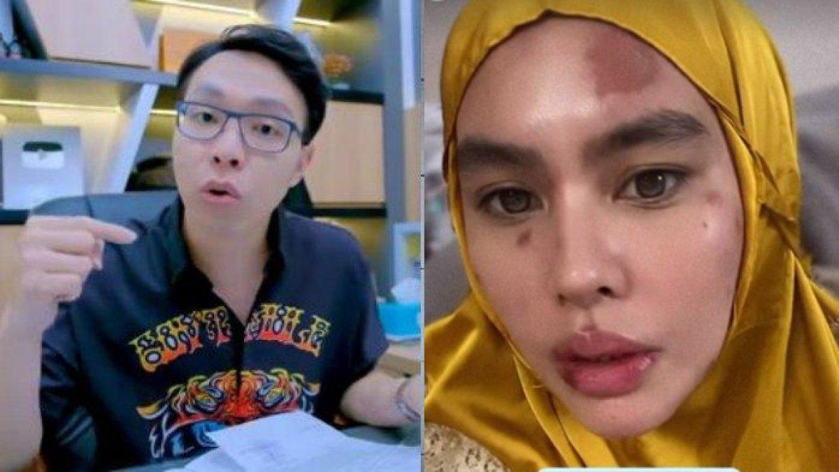 Sindiran Pedas Richard Lee untuk Ruam-ruam di Muka & Mulut Kartika ...