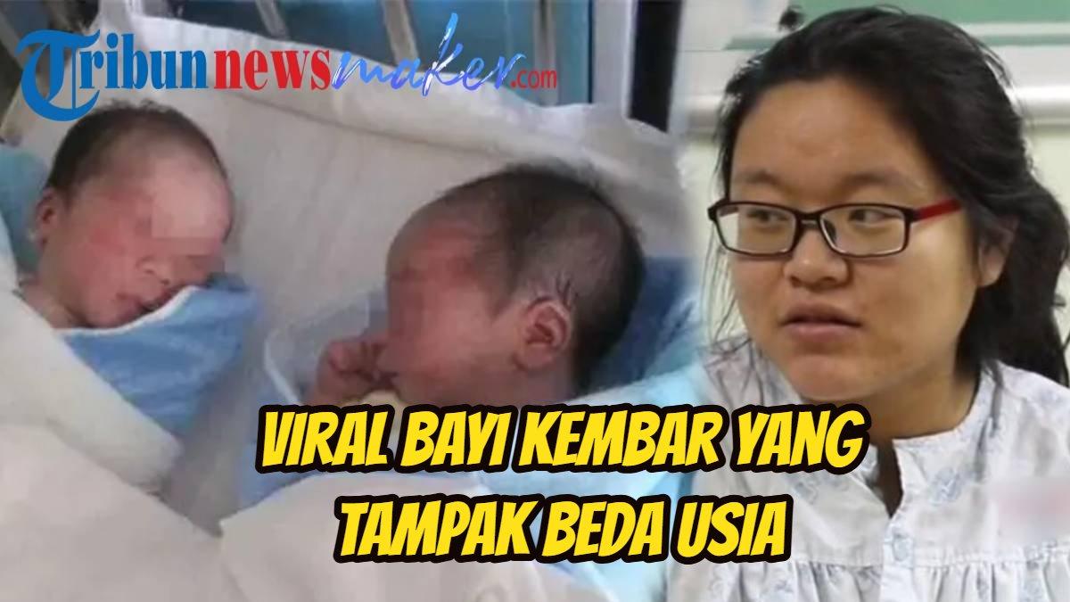 Bayi Kembar Baru Lahir Terlihat Beda, Kebahagiaan Keluarga Ini Berubah Jadi Kecemasan: Tidak ...