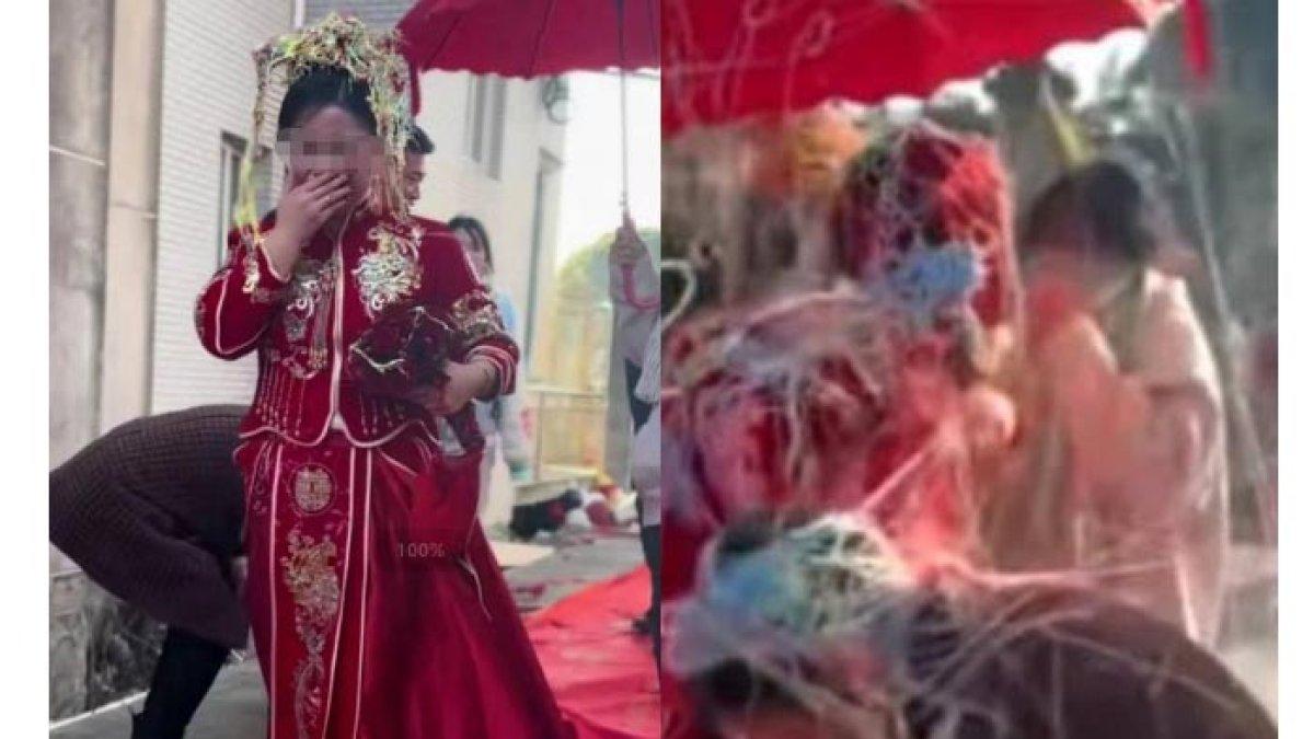 Pernikahan Berubah Tragis Wajah Pengantin Wanita Melepuh Terbakar