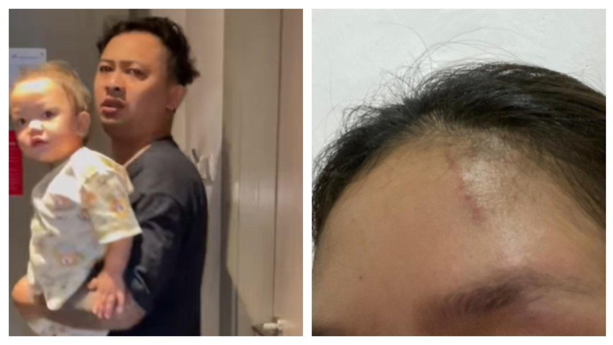 Sosok Adelia Septa, Mojang Bandung Viral Jadi Korban KDRT Suami, Sudah ...