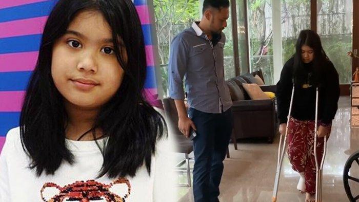 Kondisi Almira Anak AHY & Annisa Pohan Memprihatinkan, Jalan Pakai Tongkat, Cedera saat Olahraga ...