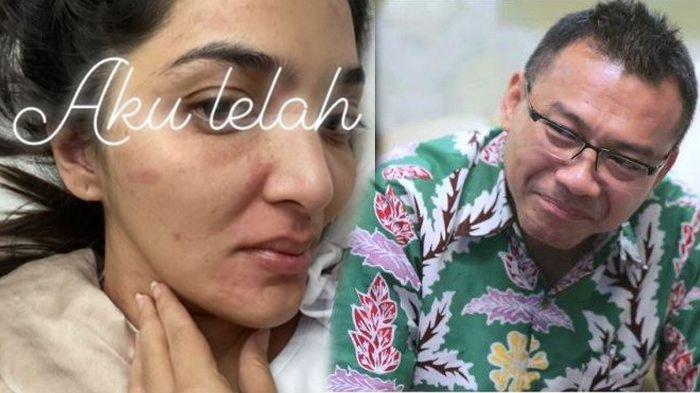 Akan Pergi ke Turki, Kondisi Ashanty Buat Anang Hermansyah Syok, Aurel ... Akan Pergi ke Turki, Kondisi Ashanty Buat Anang Hermansyah Syok, Aurel ...