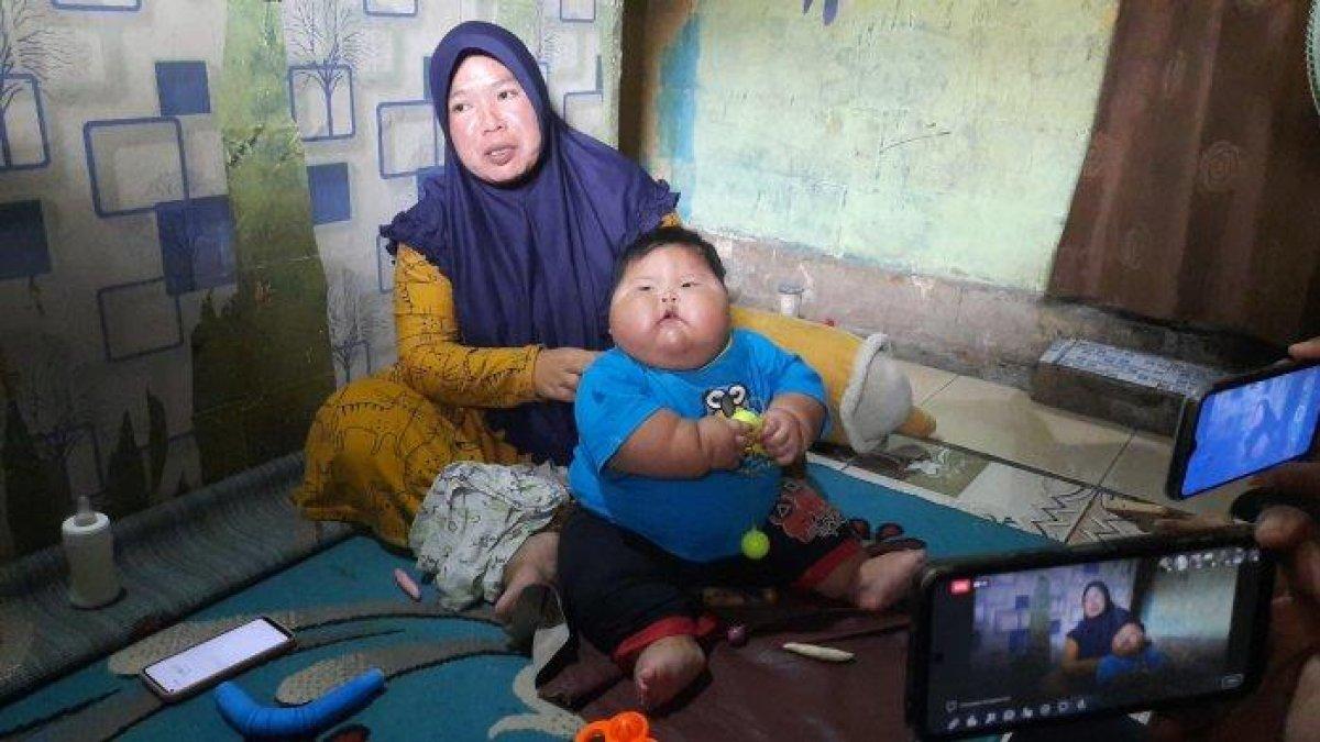 'Minum Kental Manis' Nasib Bayi 16 Bulan di Bekasi Bobot 27 Kg, Susah Berdiri, Ayah Kerja ...