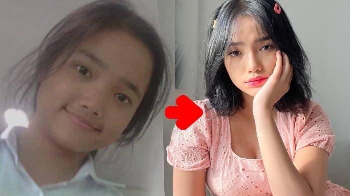 Wajah Fuji Dibilang Berubah, Adik Ipar Vanessa Angel Ngaku Lakukan ...