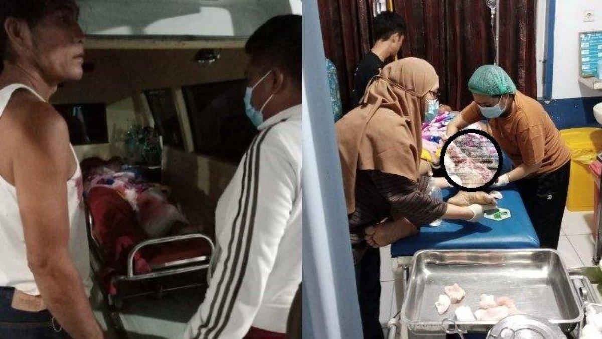 ASTAGFIRULLAH! Pria Tolitoli Nyaris Putus Kakinya Usai Diterkam Buaya, Korban Sempat Teriak ...