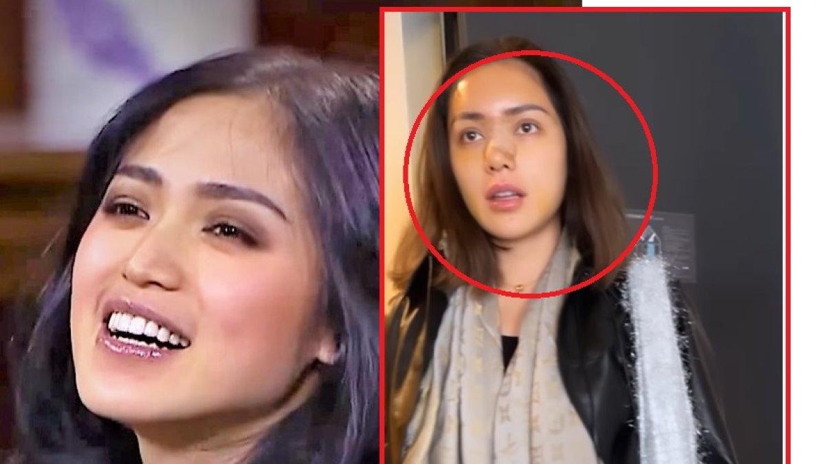 INI DIA! Wajah Jessica Iskandar Sebelum dan Sesudah Operasi Plastik ...