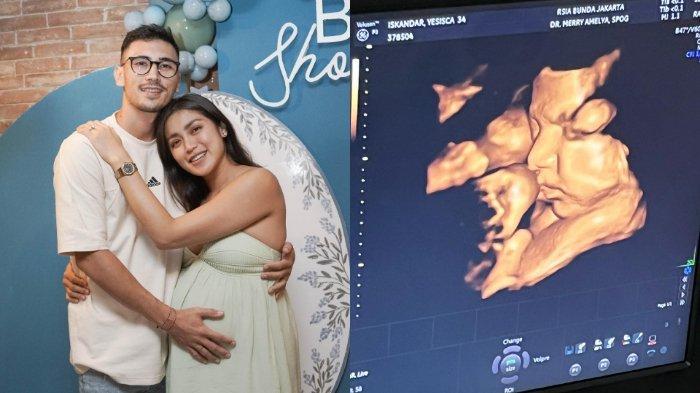 KONDISI Janin di Dalam Kandungan Tak Biasa, Buat Jedar & Vincent ...