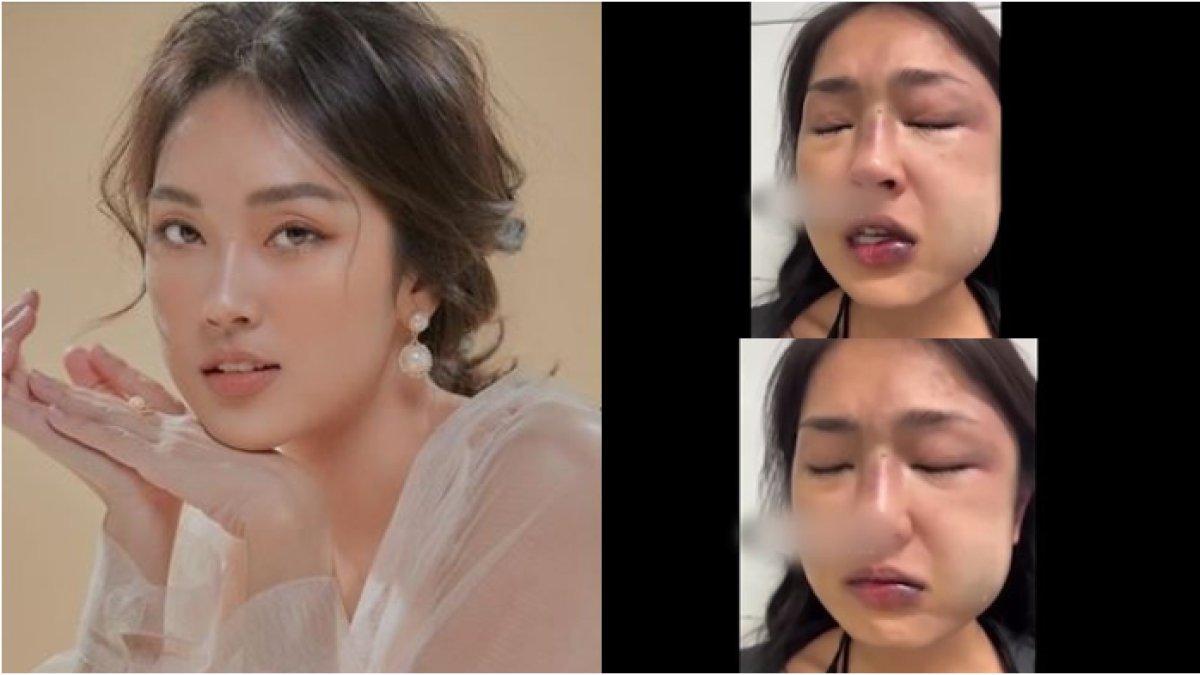 PERGOKI Pacar Selingkuh, Nasib Artis Buat Fans Nangis, Babak Belur Dipukuli, Wajah Membiru ...