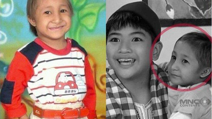 5 FAKTA Dicky Topan Pemeran Adik Si Entong, Jejak Karier hingga Sakit ...