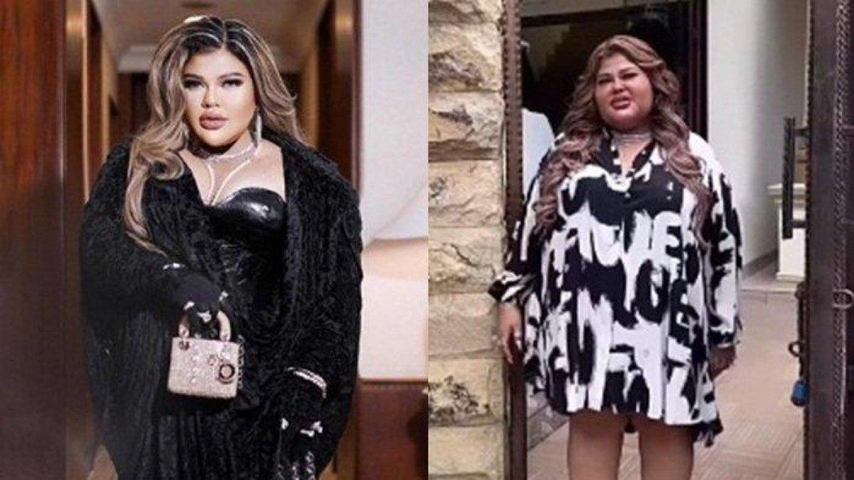 SOSOK Shindy Samuel, Selebgram Obesitas Berhasil Turun 34 Kg, Dulu ASN ...