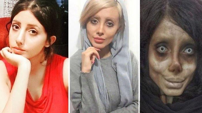 5 Potret Transformasi Sahar Tabar Sebelum vs Sesudah Oplas, Selebgram ...