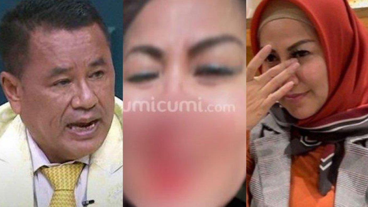 Pasca di KDRT, Venna Melinda Minta Bantuan Hotman Paris, Curhat Ferry Tak Segera Ditahan: Kecewa ...