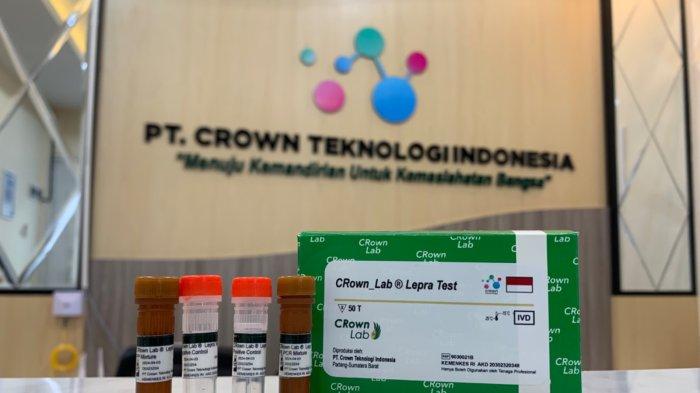 Komitmen Bantu Pemerintah, PT Crown Teknologi Indonesia Siapkan Produk ...