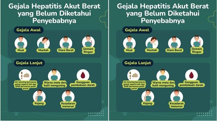 Mengenal Gejala Hepatitis Akut Berat Belum Diketahui Penyebabnya, Ini ...