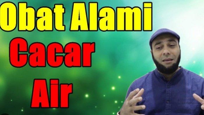 Obat Cacar Air ala dr Zaidul Akbar, Pakai Bahan-bahan Herbal, Ampuh Supaya Virusnya Cepat Mati ...