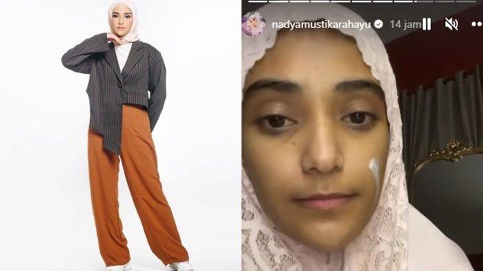 Badan Kurus Kering, Nasib Nadya Mustika Eks Rizki DA Dikasihani, Ibu ...