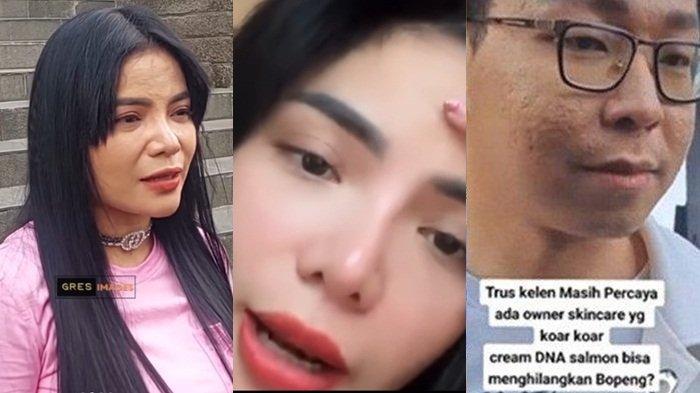 Senasib Richard Lee, Wajah Asli Dinar Candy Dikuliti, Reaksi Menohok Eks Ridho Ilahi jadi ...