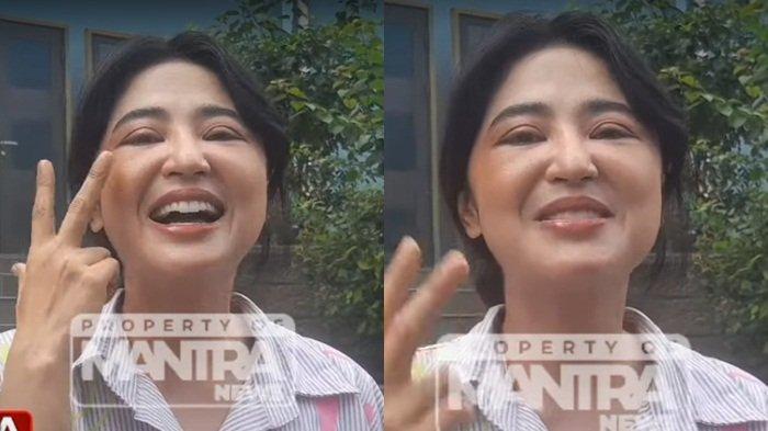 Muka Dewi Persik Bengkak, Tampang Depe Pasca Operasi Disorot, Tambah ...