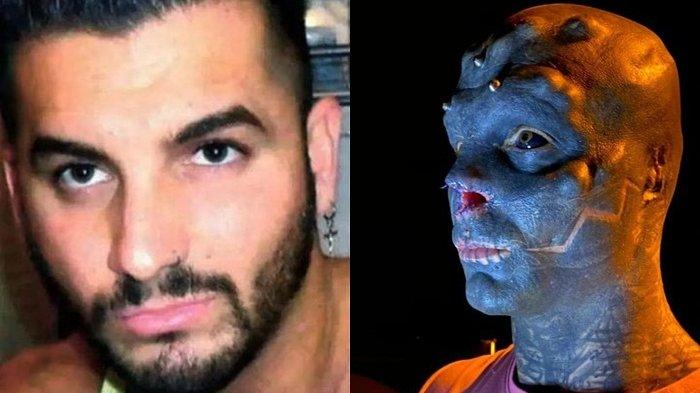 PRIA Tampan Ini Nekat Ingin Wajahnya Jadi Alien, Rela Hidungnya di ...