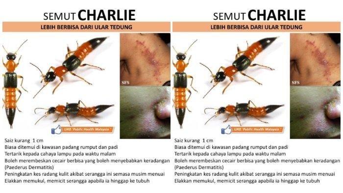 Bahaya Semut Charlie atau Tomcat yang Beracun pada Kulit Viral ...