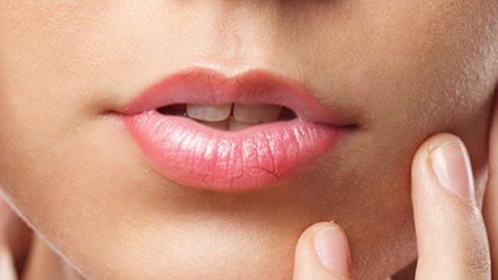 Inilah 6 Cara Cegah Bibir Kering dan Pecah-pecah Selama Bulan Ramadan ...