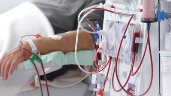 Inilah Efek Samping Cuci Darah untuk Gagal Ginjal: dari Tekanan Darah ...