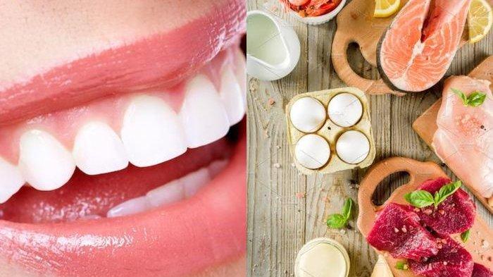 7 Makanan Sehat Untuk Jaga Gigi Tetap Kuat - Sripoku.com